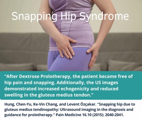 Snapping Hip Syndrome and Athletes - Peter A. Fields, MD, DC