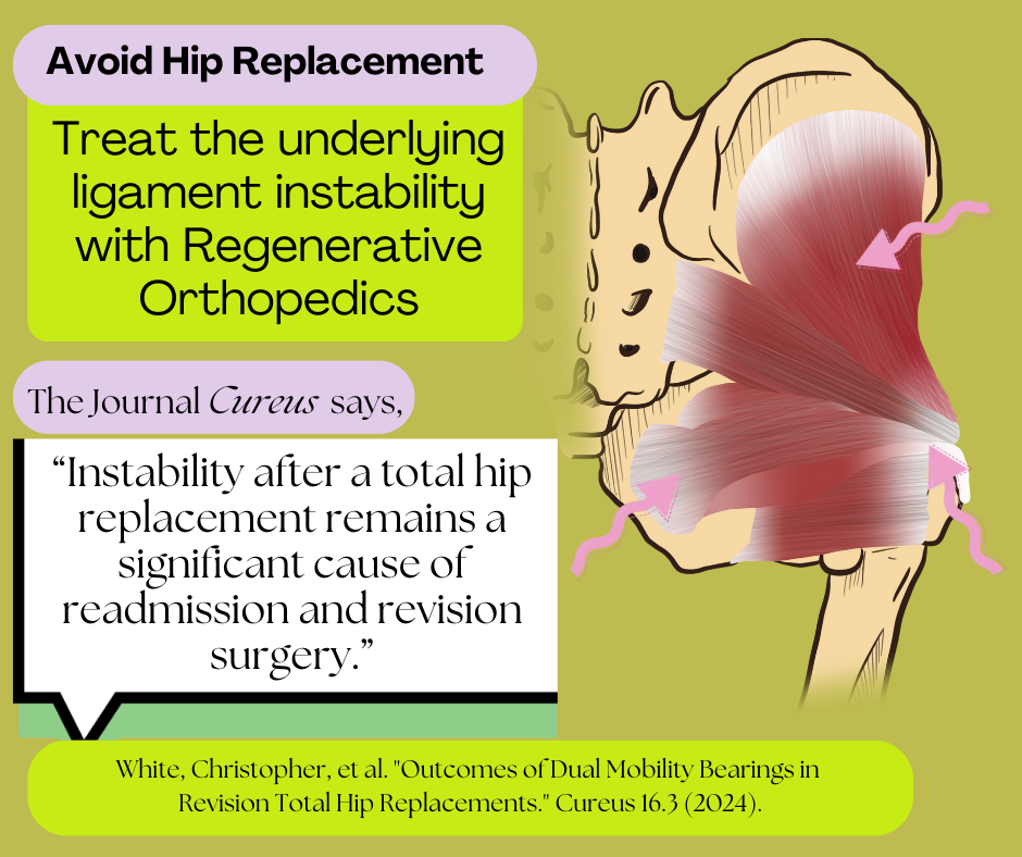 Hip Arthritis Treatment