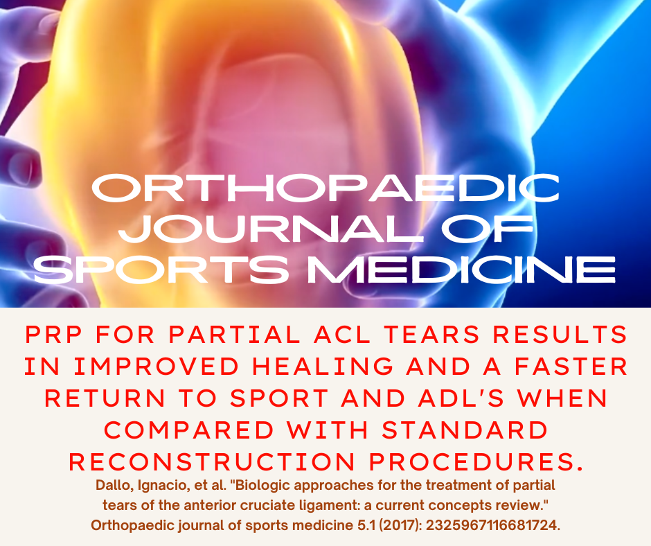 ACL TEAR Repair - Peter A. Fields, MD, DC